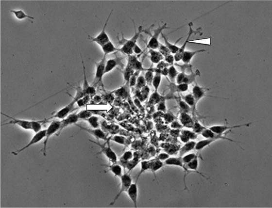 SH-SY5Y Cell Line Culture Protocol and Research Applications - PharmiWeb.com
