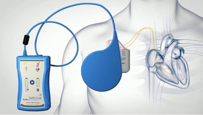 Smart Implantable Pumps Revolution: Improving Treatment Efficacy and ...