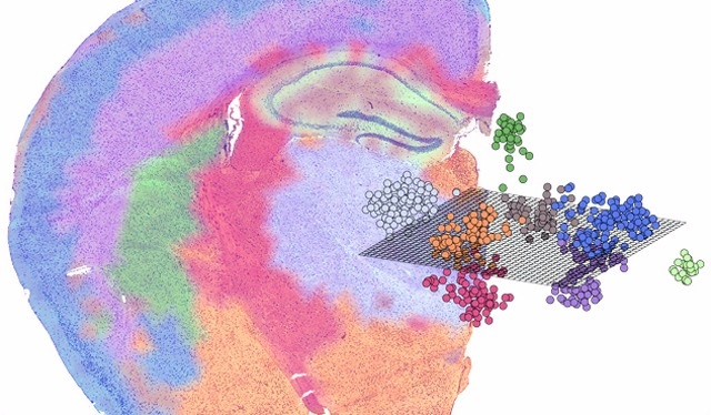 Spatial Transcriptomics Market to Surpass $1.6 Billion by 2034 with a ...