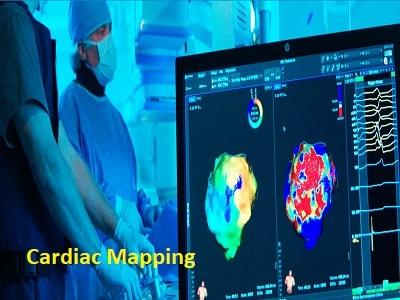 Cardiac Mapping Market Projected to Reach USD 5.5 Billion by 2034 ...