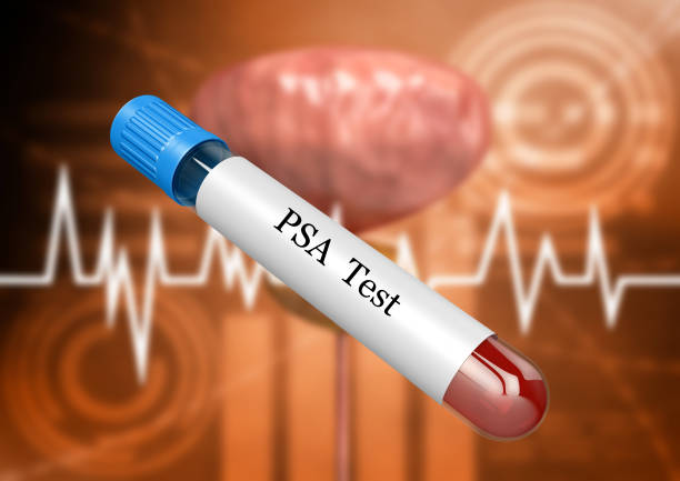 Prostate Specific Antigen (PSA) Testing Market Valuation and Growth ...